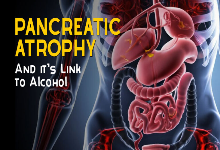 Atrophic Pancreas or Pancreatic Atrophy and Its Link to Alcohol ...